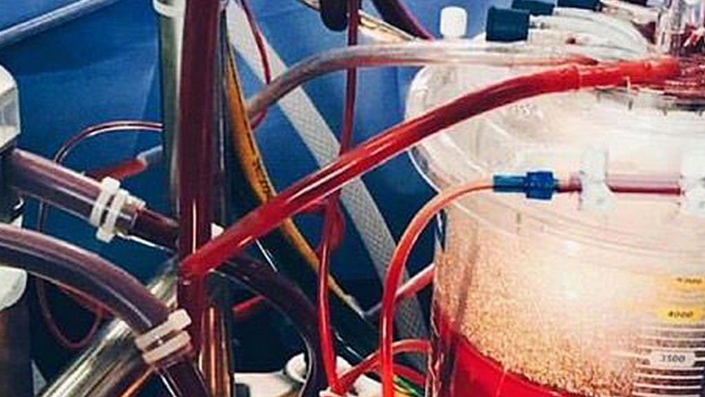 Kardiopulmonêre bypassmasjiene