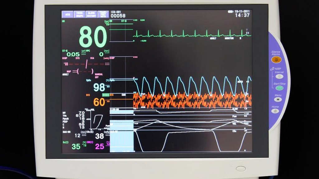 Gerekenariseerde EKG-analisestelsels