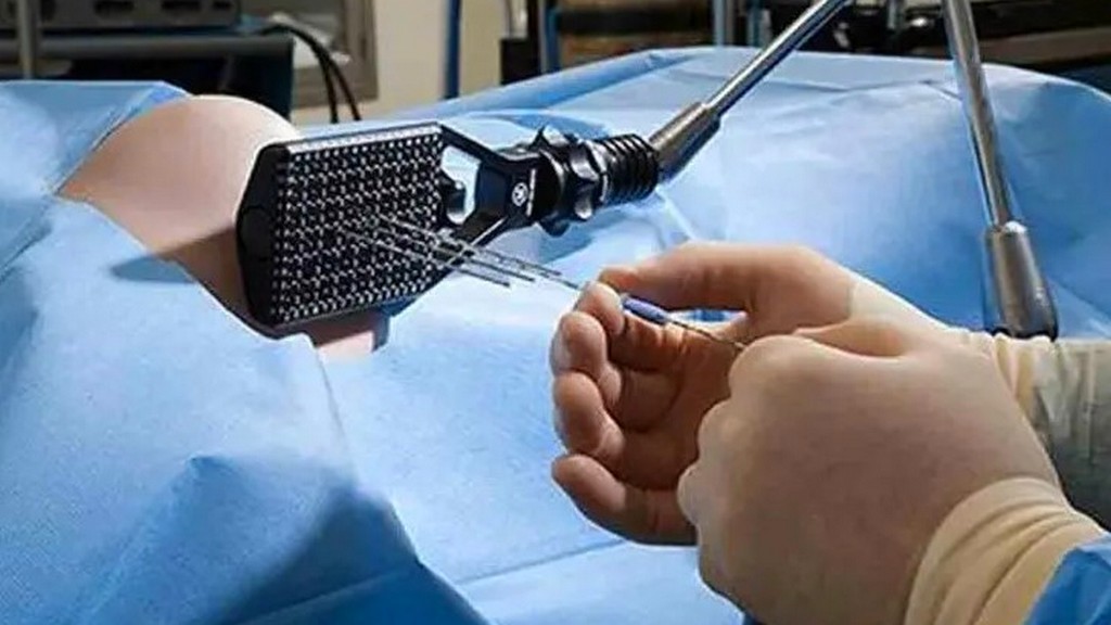 Brachytherapy Needles and Applicators