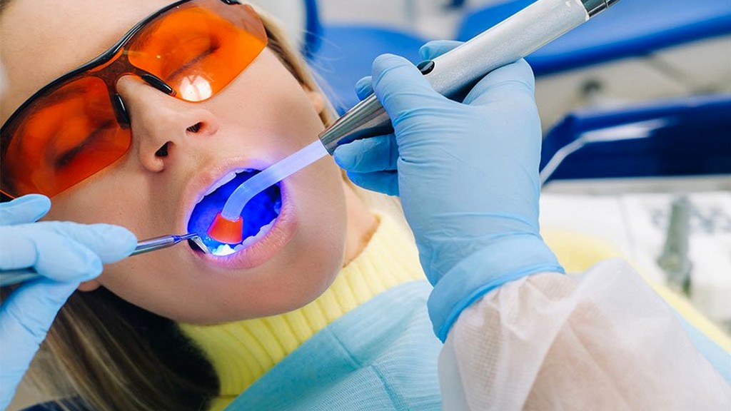 Dental Bleaching Lights