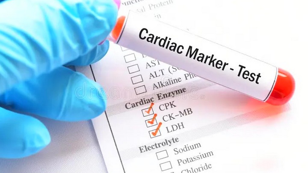 Inflammation Marker Test Kits