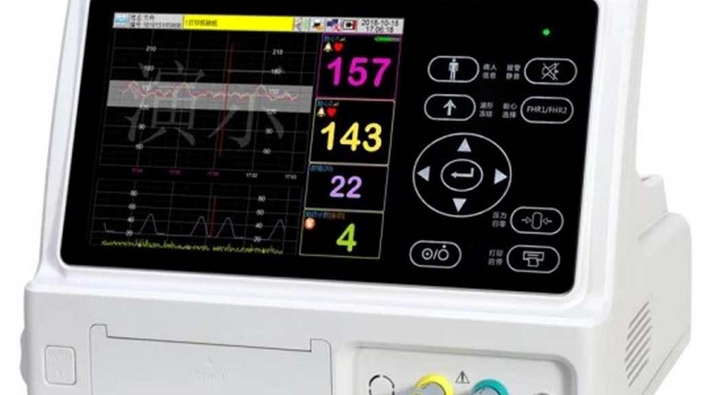Toestelle vir monitering van fetale bewegings