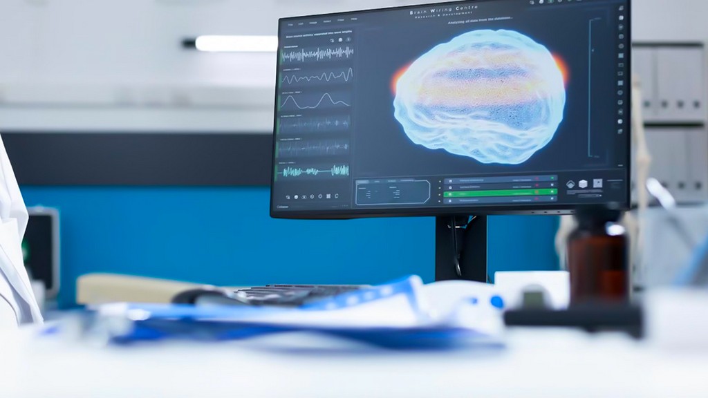 Neurological Monitors