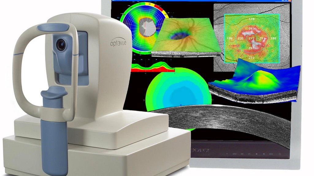 Optical Coherence Tomography (OCT) Devices