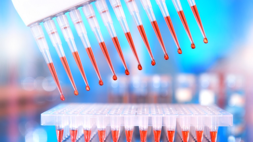 Automated Pipetting Systems