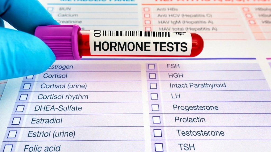 Reproduktif Hormon Test Kitleri