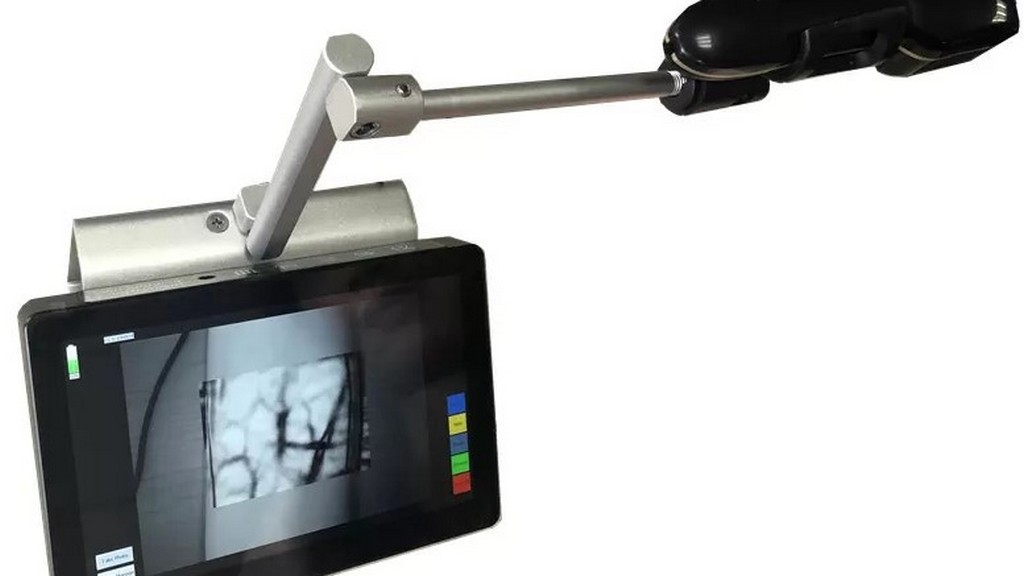 Vaskulêre ultraklanktoestelle